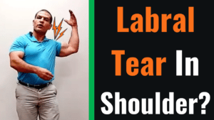 Labral Tear In Shoulder | Symptoms, Treatment, & Exercises