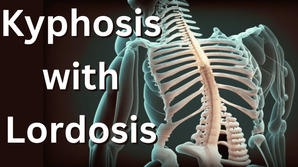 Kyphosis with Lordosis Curve of the Spine: Causes and Treatment