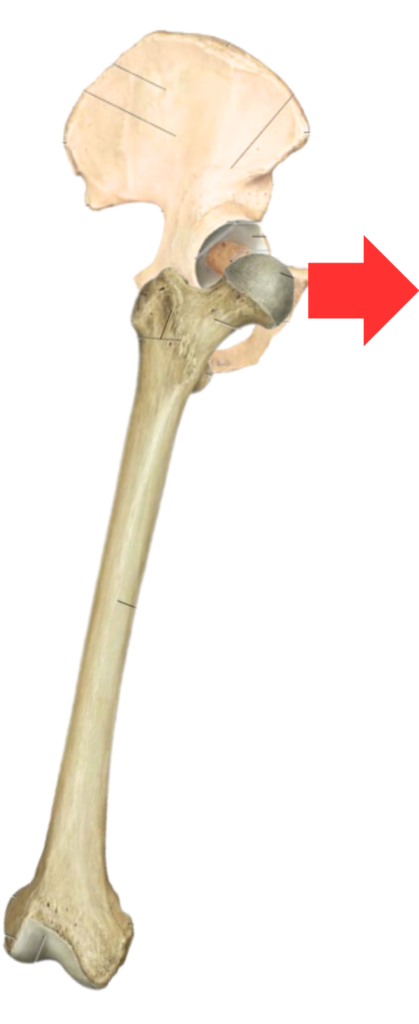 Stop Pain In Front Of Hip Joint Near Groin When Walking