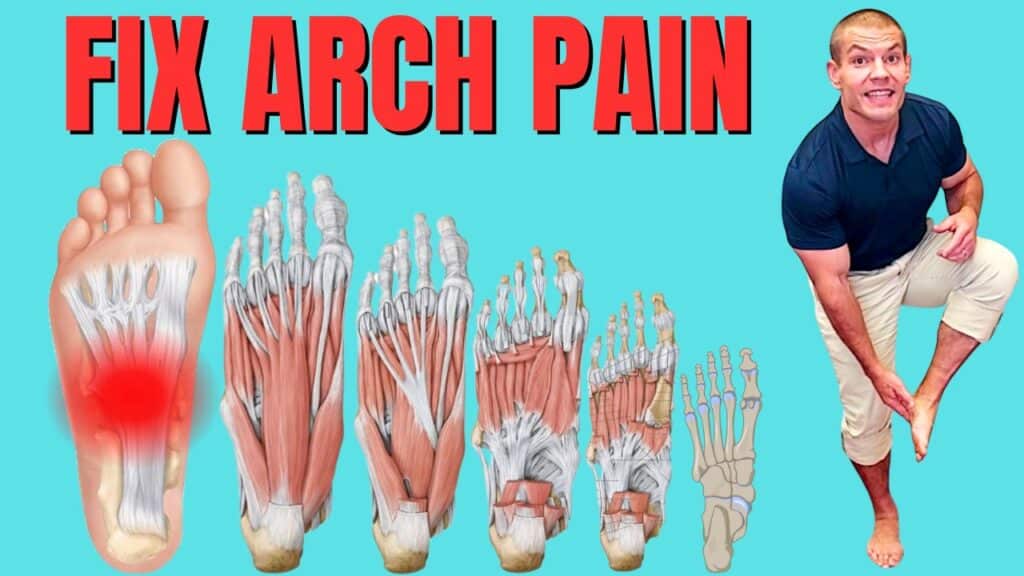 5 Simple Tips To Fix Foot Arch Pain Walking