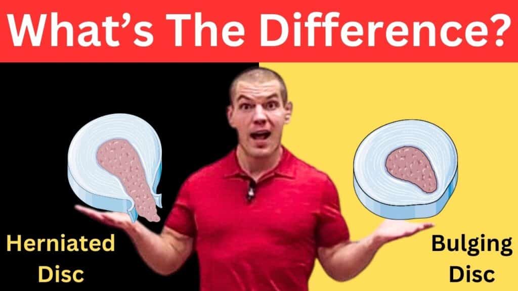 Herniated Disc vs Disc Bulge: What's The Difference?