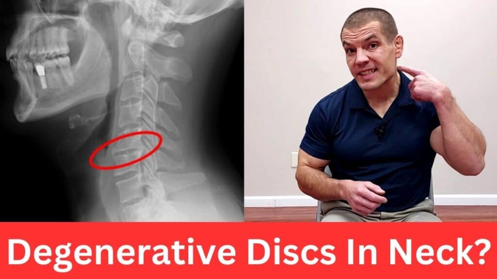 3 Exercises For Cervical Degenerative Disc Disease