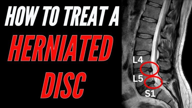 How To Treat A Herniated Disc At L4-L5 or L5-S1